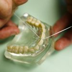 ScanBox Is A Device That Lets You Take Images Of Your Teeth For Virtual ...