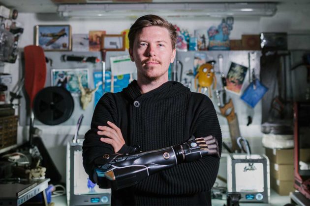 Hero Arm 3D-printed Bionic Arm Gives Below Arm Amputees A New Hope
