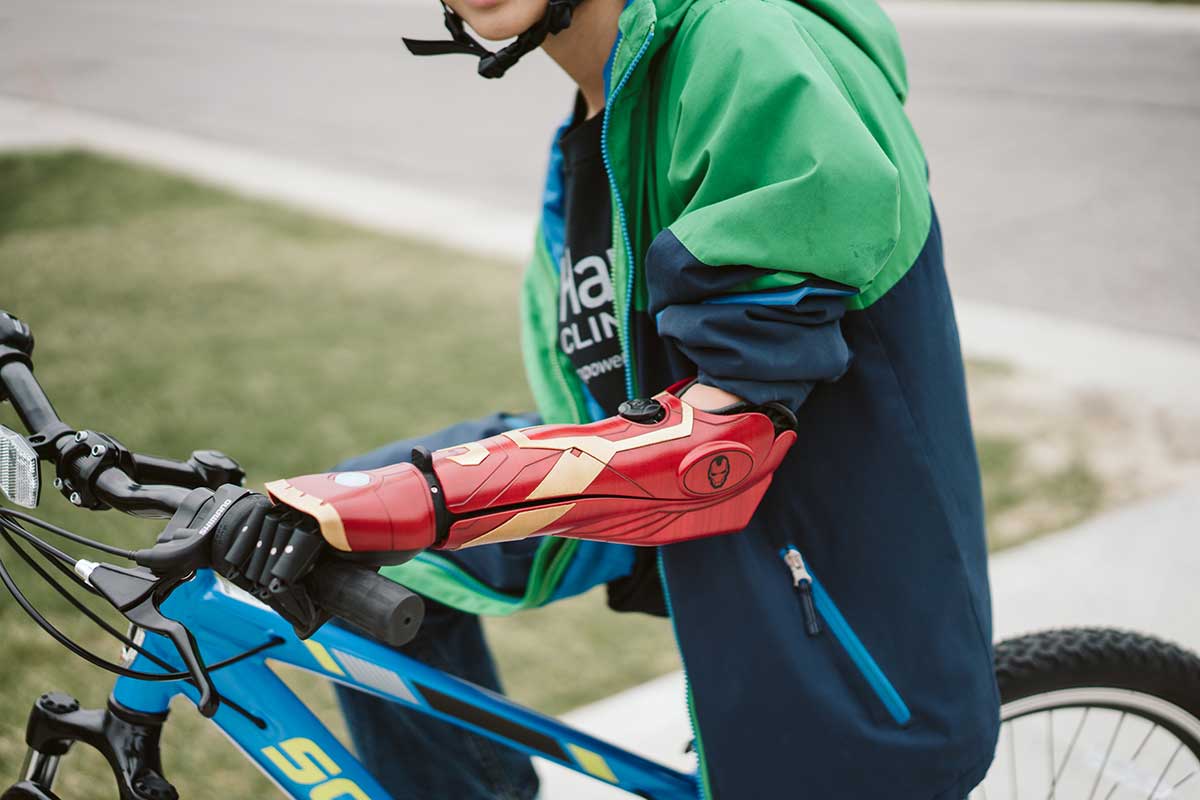 Hero Arm 3D-printed Bionic Arm Gives Below Arm Amputees A New Hope