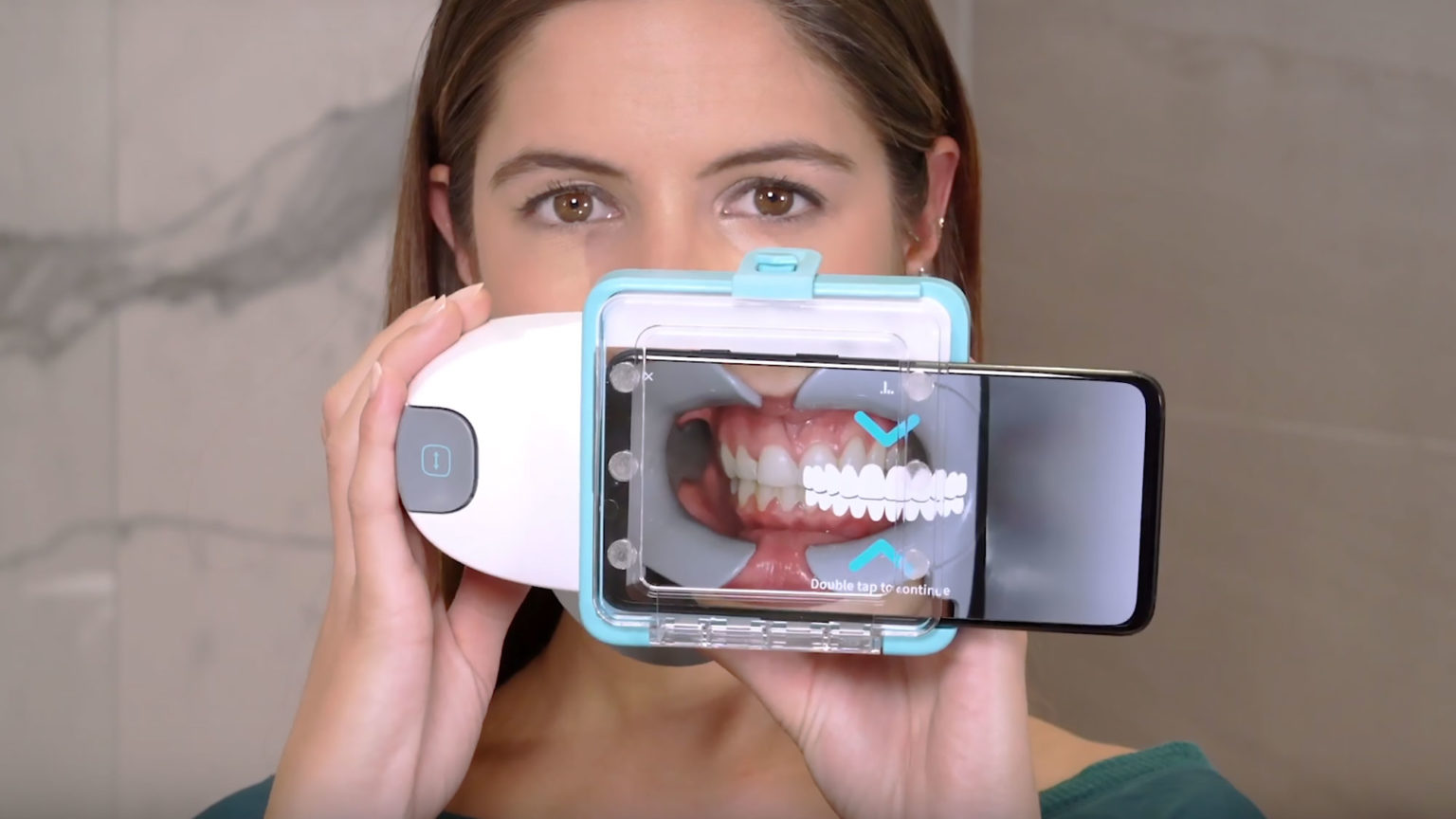 ScanBox Is A Device That Lets You Take Images Of Your Teeth For Virtual ...