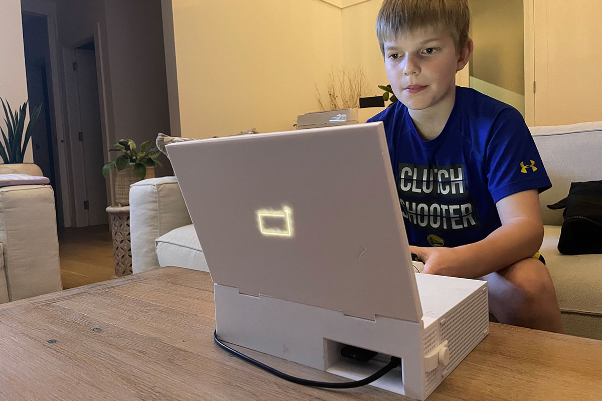 xScreen Will Turn Your Xbox Series S Into A Laptop With Zero ...