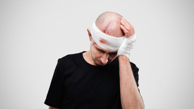 What Factors That Influence The Value Of A Head Injury Claim?